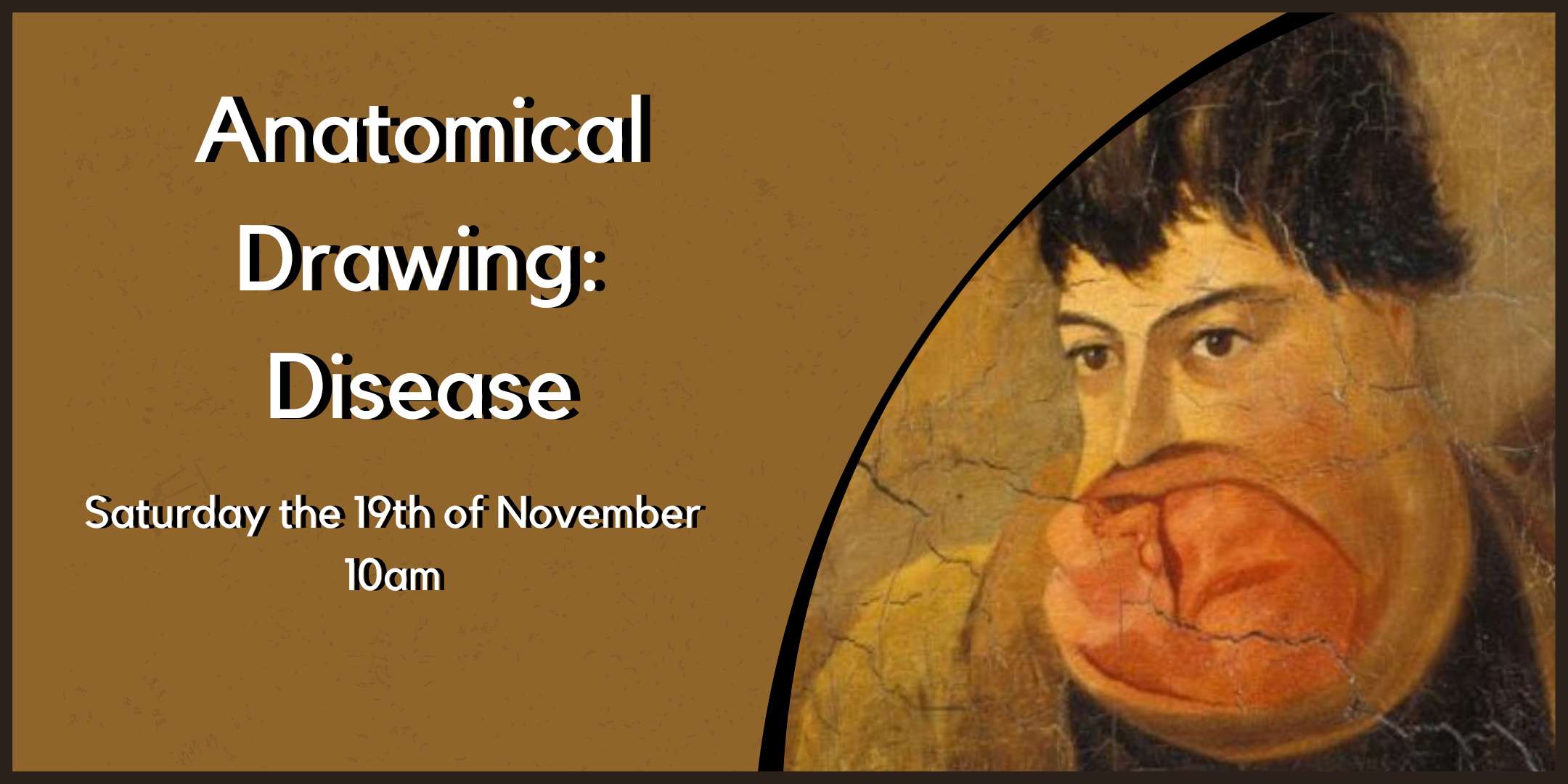 Anatomical Drawing : Disease - Surgeons' Hall Museums, Edinburgh